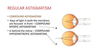 Astigmatism, Classification, Sturm's conoid | PPTX