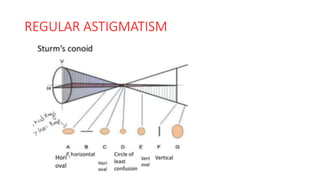 Astigmatism, Classification, Sturm's conoid | PPTX
