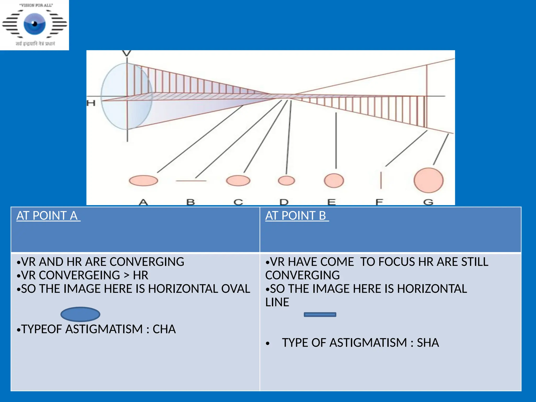 ASTIGMATISM.pptx........................ | PPTX