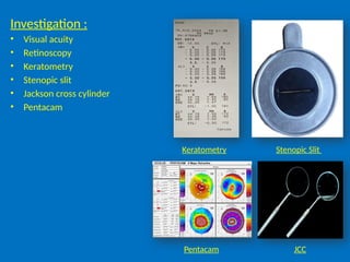 ASTIGMATISM.pptx........................ | PPTX