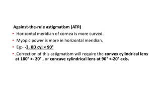 Astigmatism.pdf_for Optometry Students.. | PDF