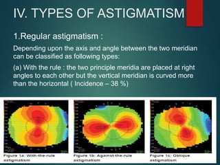 Astigmatism-Types and its Management.pptx