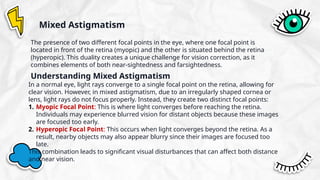 astigmatism their type , ways of astigmatism | PPT