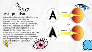 astigmatism their type , ways of astigmatism | PPTX