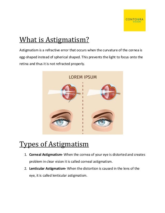 Astigmatism Causes Symptoms And Treatment