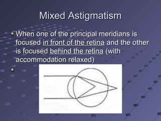 Astigmatism Example