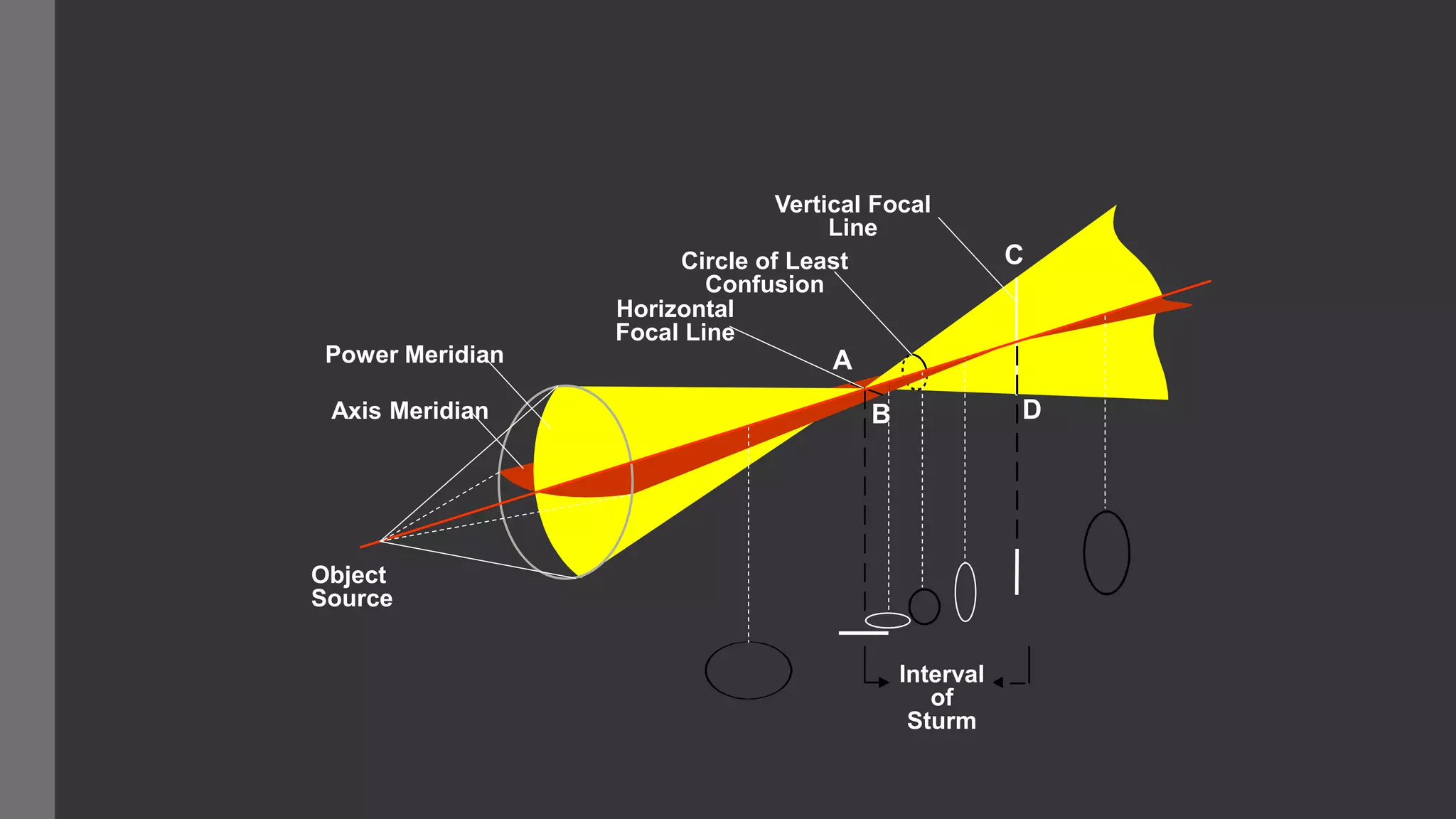 Astigmatism, anisometropia, anisekonia. | PPTX