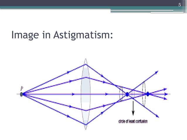 Astigmatism AVF (2).pptx . . . . . . . . . . . | PPTX | Eye and Vision ...