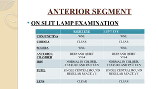 ASTIGMATISM TYPES CASE PRESENTATION.pptx