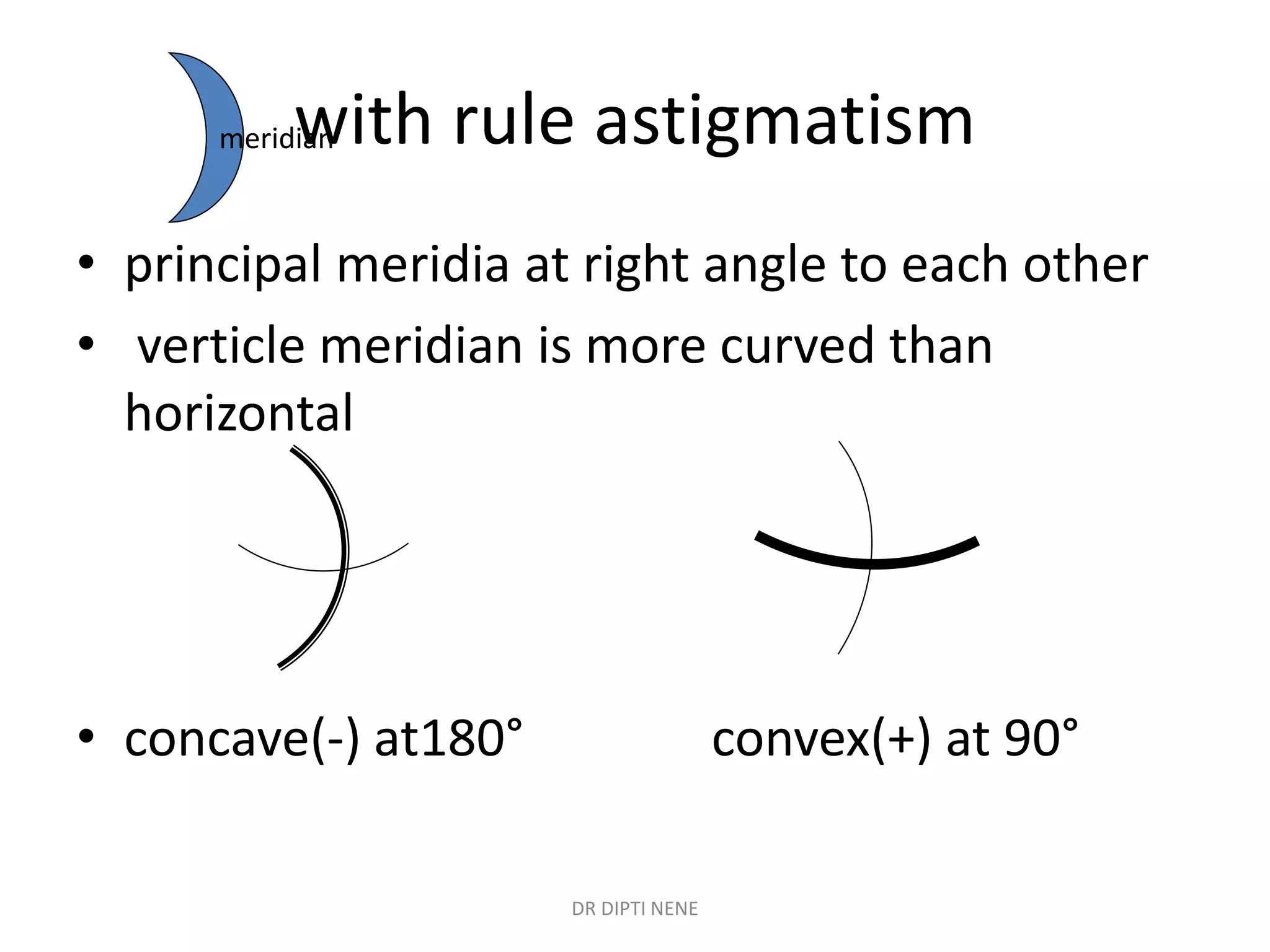 Astigmatism complete | PPTX