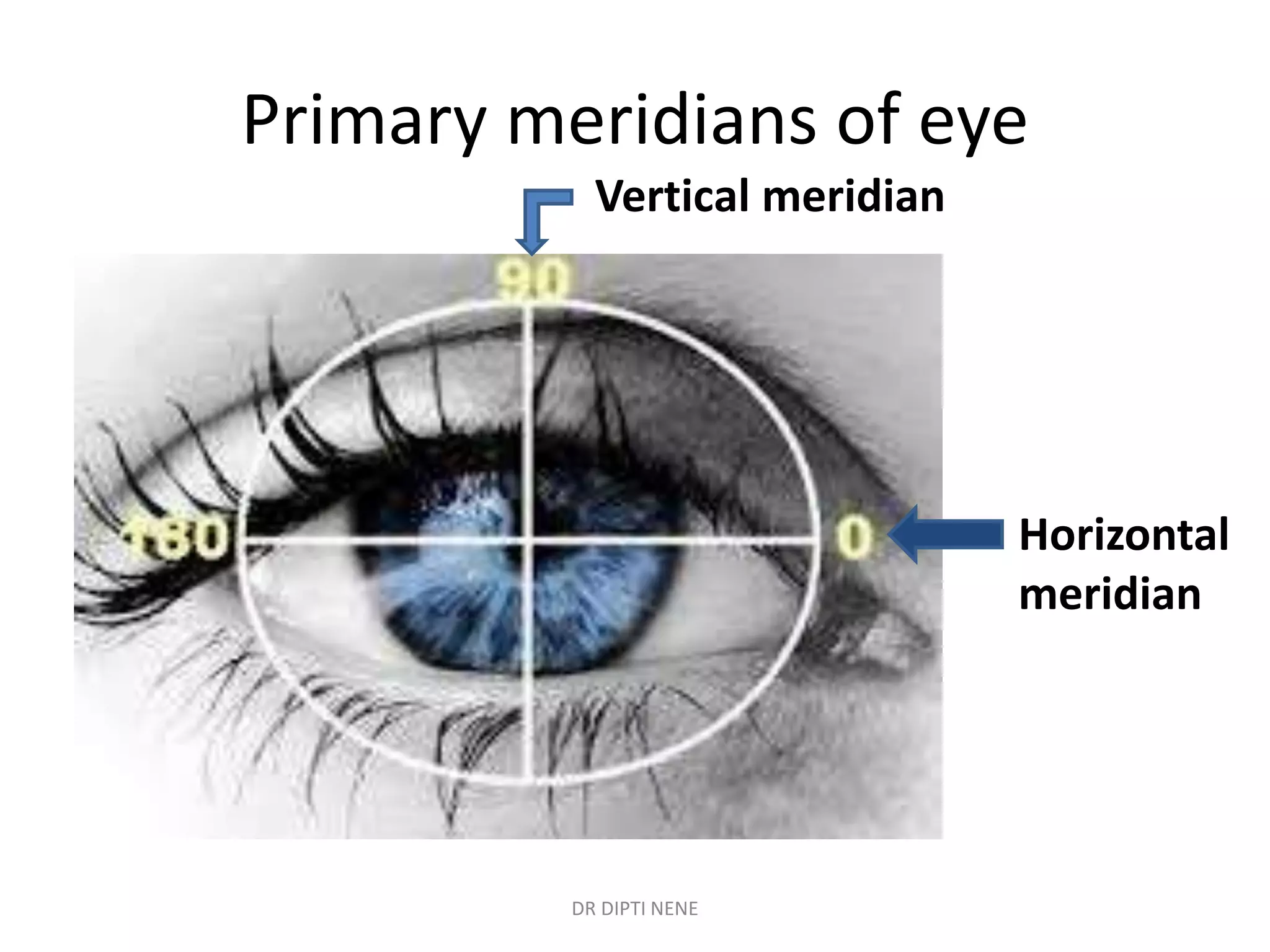 Astigmatism complete | PPTX