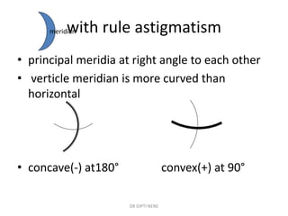 Astigmatism complete | PPTX