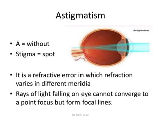 Astigmatism complete | PPTX
