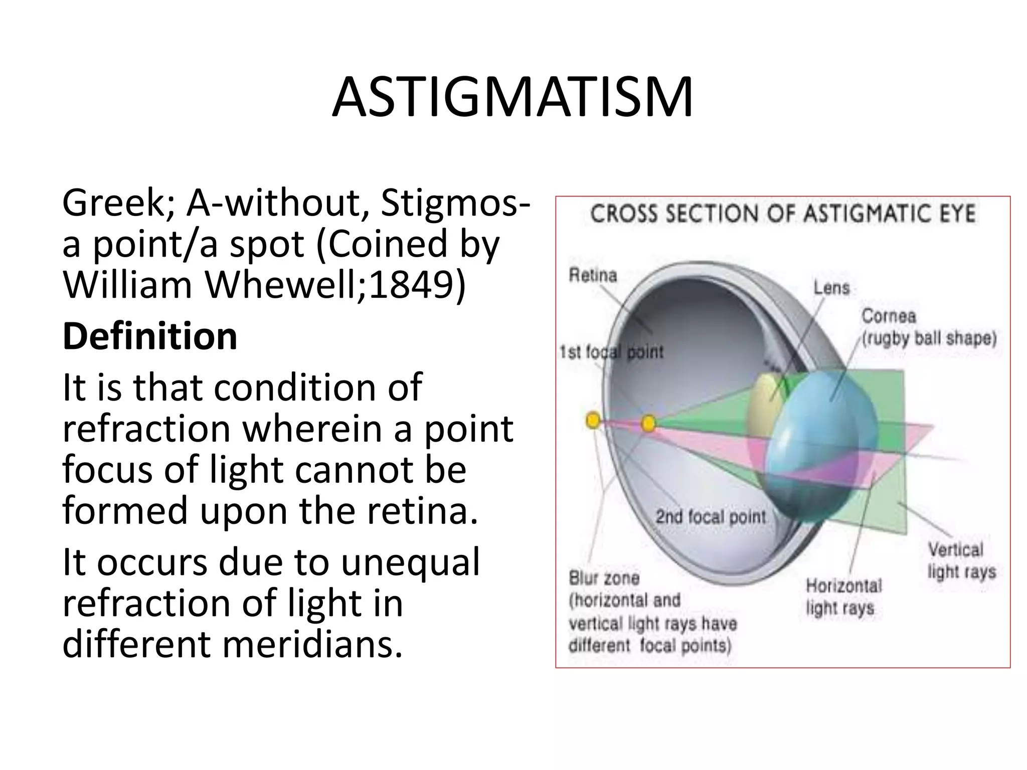 Astigmatism, presbyopia and aphakia | PPTX