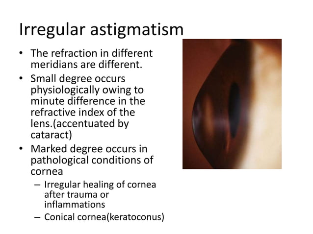 Astigmatism, presbyopia and aphakia | PPTX | Eye and Vision Conditions ...