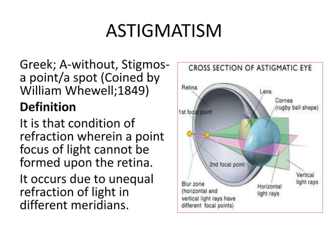 Astigmatism, presbyopia and aphakia | PPTX | Eye and Vision Conditions ...