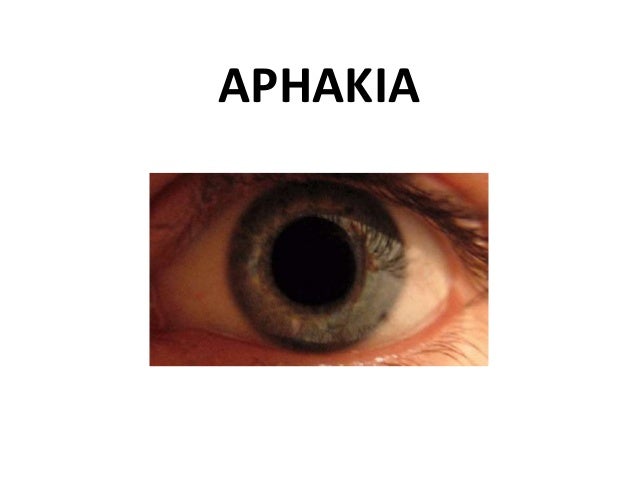 Astigmatism, presbyopia and aphakia