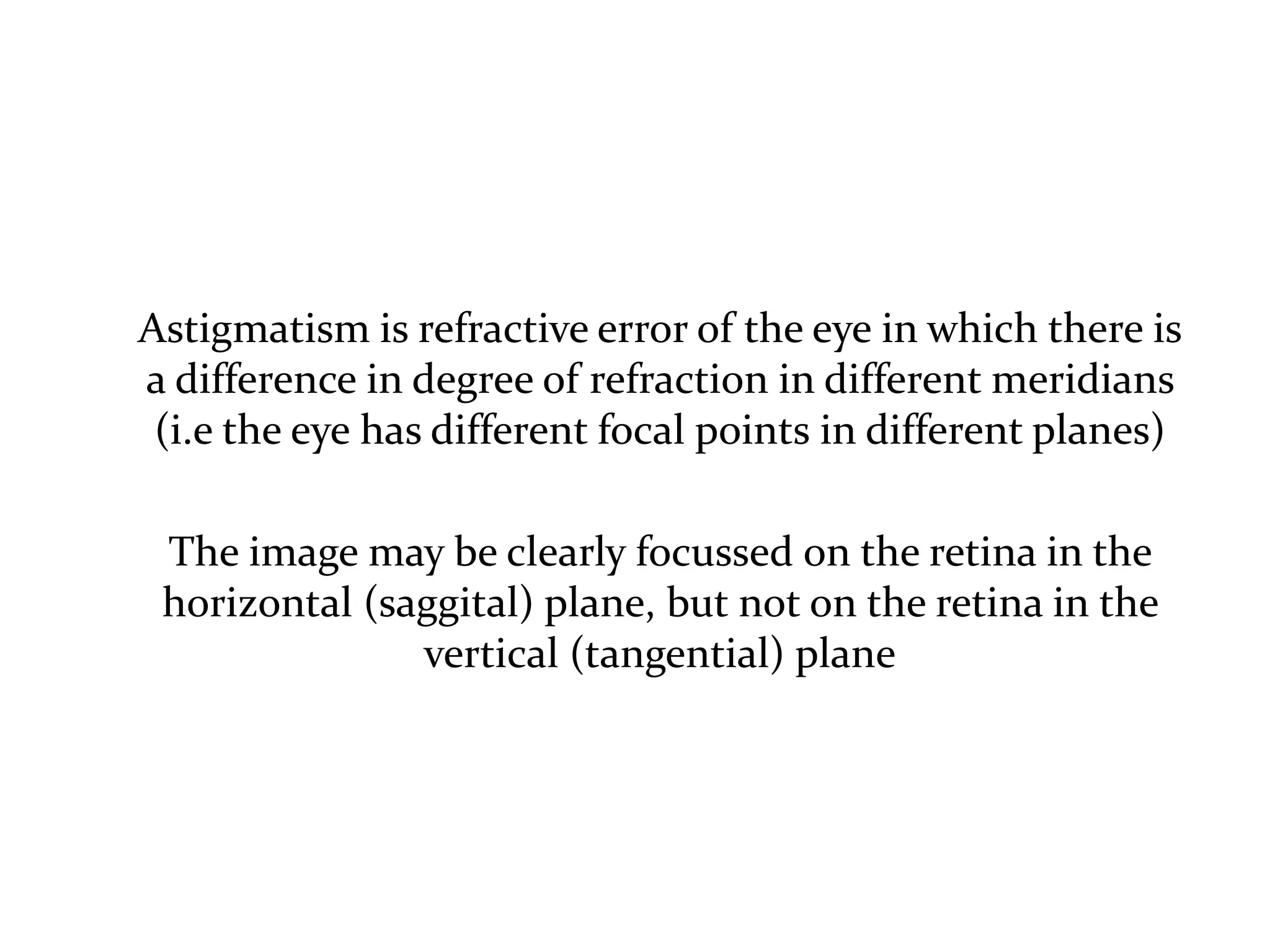 Astigmatism | PPTX