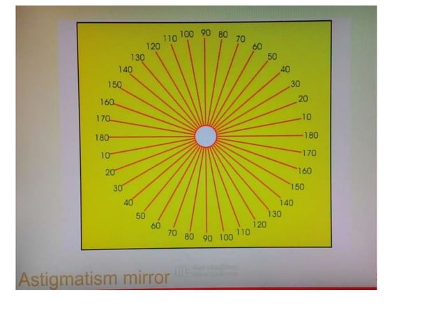 Astigmatism | PPTX
