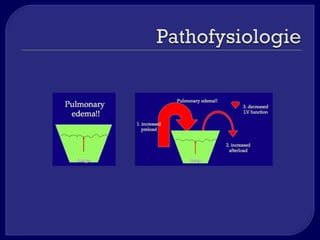 Astma cardiale topics | PPT