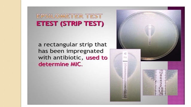 AST Methods_Practical No. 8.pptx | Infectious Diseases | Diseases and ...