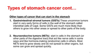Stomach cancer | PPTX