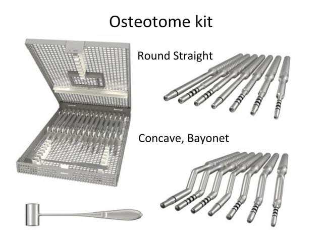 Astra Dental Implant System | PPT