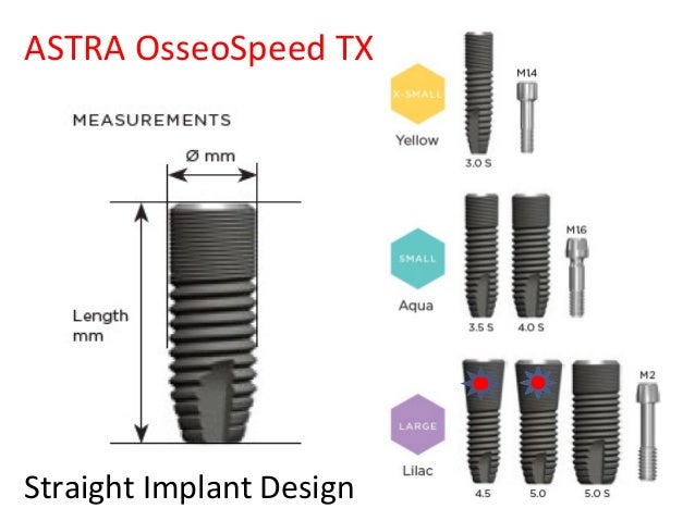 Astra Dental Implant System
