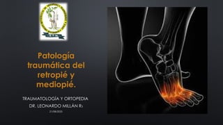 ANATOMIA DE ASTRAGALO TRAUMATOLOGIA Y ORTOPEDIA | PPTX