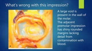 Astrigents and Gingival Retraction, Digital Impressions, Inelastic ...