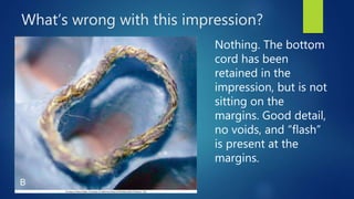 Astrigents and Gingival Retraction, Digital Impressions, Inelastic ...