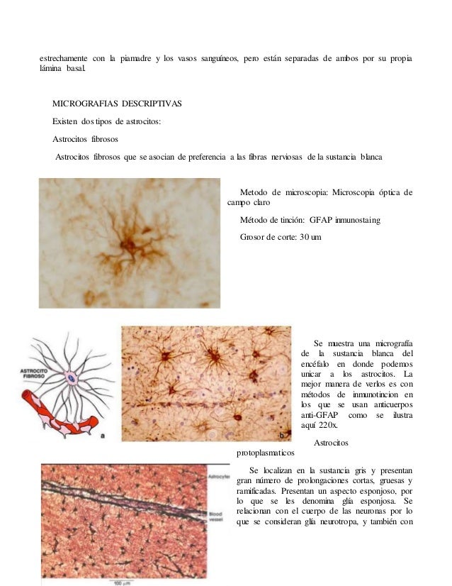 Los Astrocitos