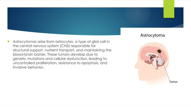 ASTROCYTOMA full and case study PPTX.pptx