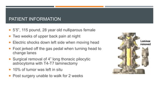 Using SOT Blocks to Remove Symptoms from Astrocytoma Surgery | PPTX