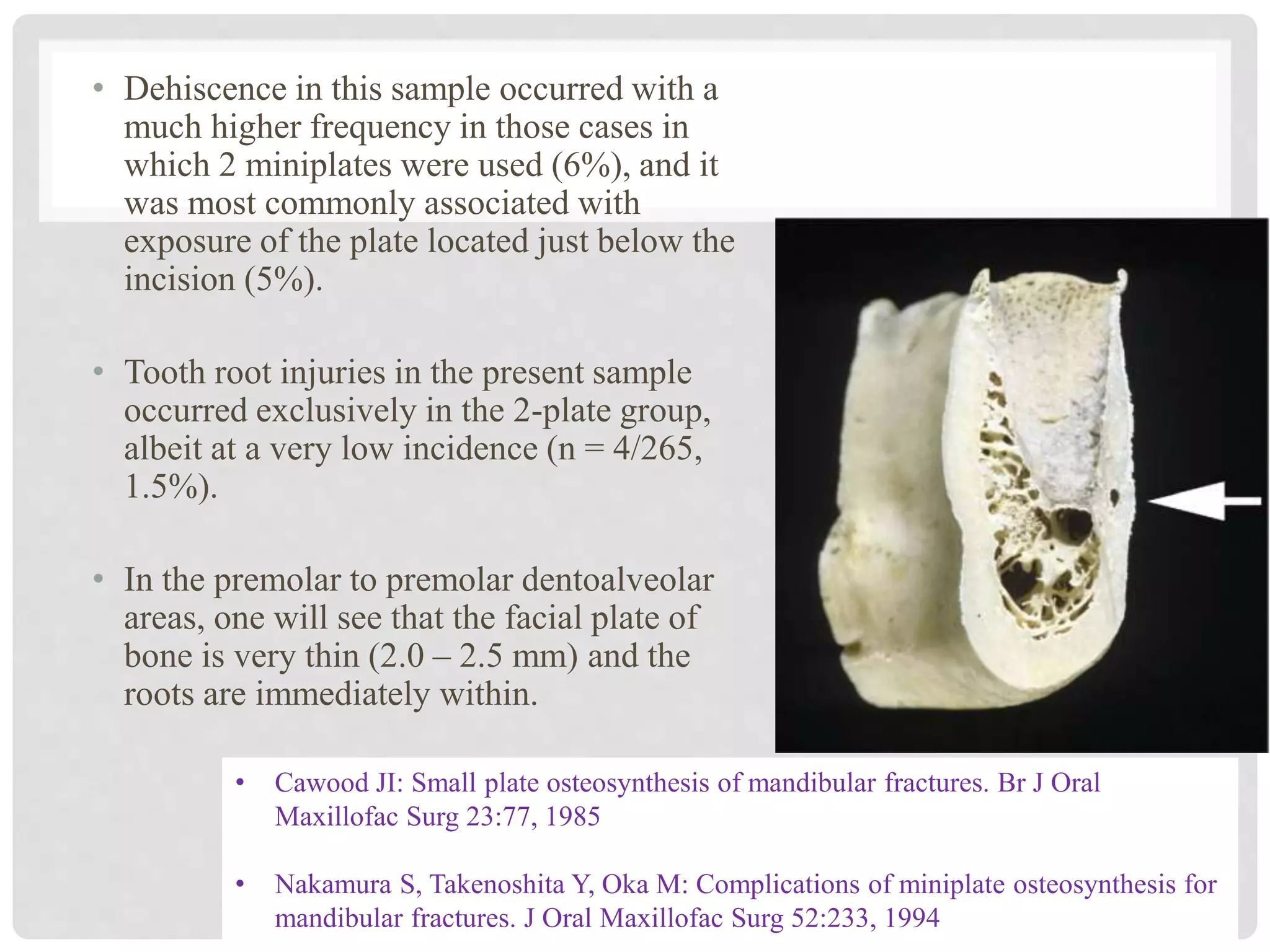A study of 2 bone plating methods for fractures of mandibular symphysis ...