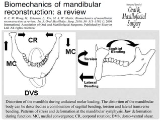A study of 2 bone plating methods for fractures of mandibular symphysis ...