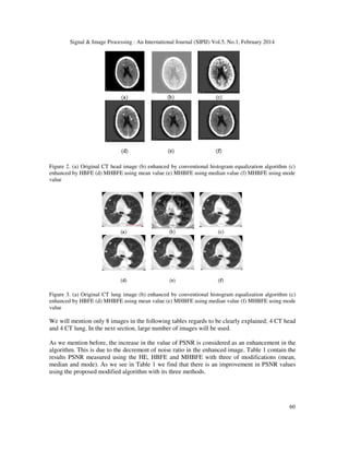 A study of a modified histogram based fast enhancement algorithm (mhbfe) | PDF