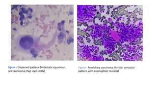 A study of cellular pattern of thyroid lesion- oral paper_011940.pptx