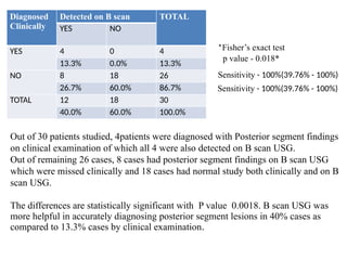 A Study on Role of B-scan Ultrasound Biomicroscopy POSTER.pptx