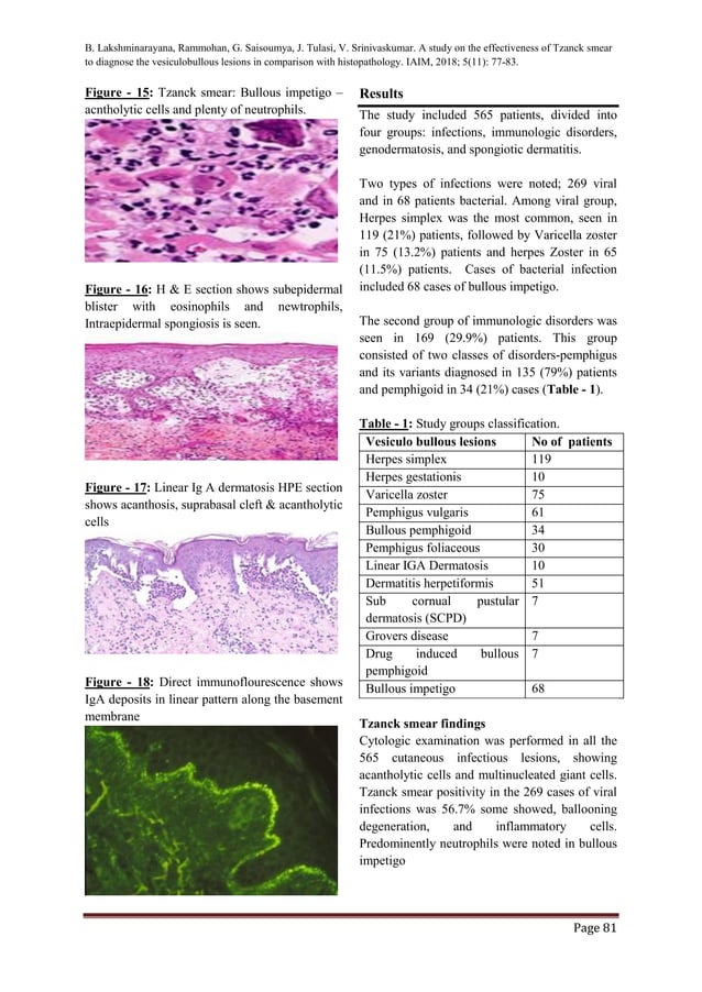 A study on the effectiveness of tzanck smear to diagnose the ...