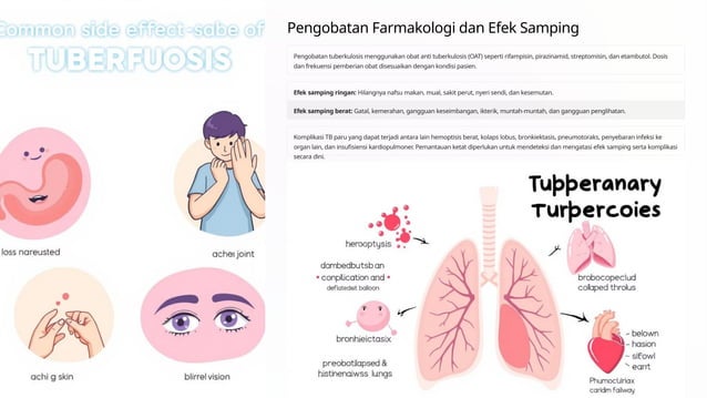 Asuhan-Keperawatan-pada-Pasien-TB-Paru.pptx