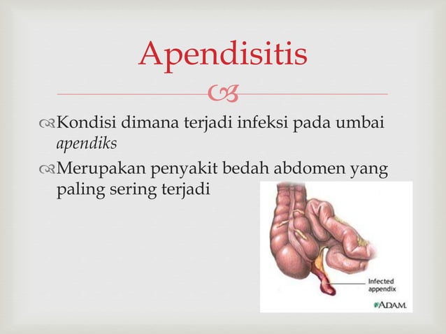 Asuhan keperawatan apendisitis | PPTX