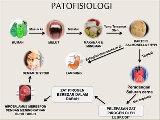 Asuhan Keperawatan Demam Thypoid | PPT