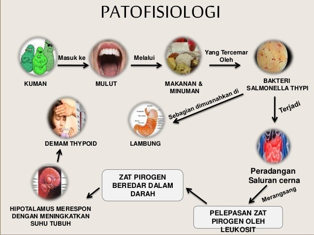 Asuhan Keperawatan Demam Thypoid