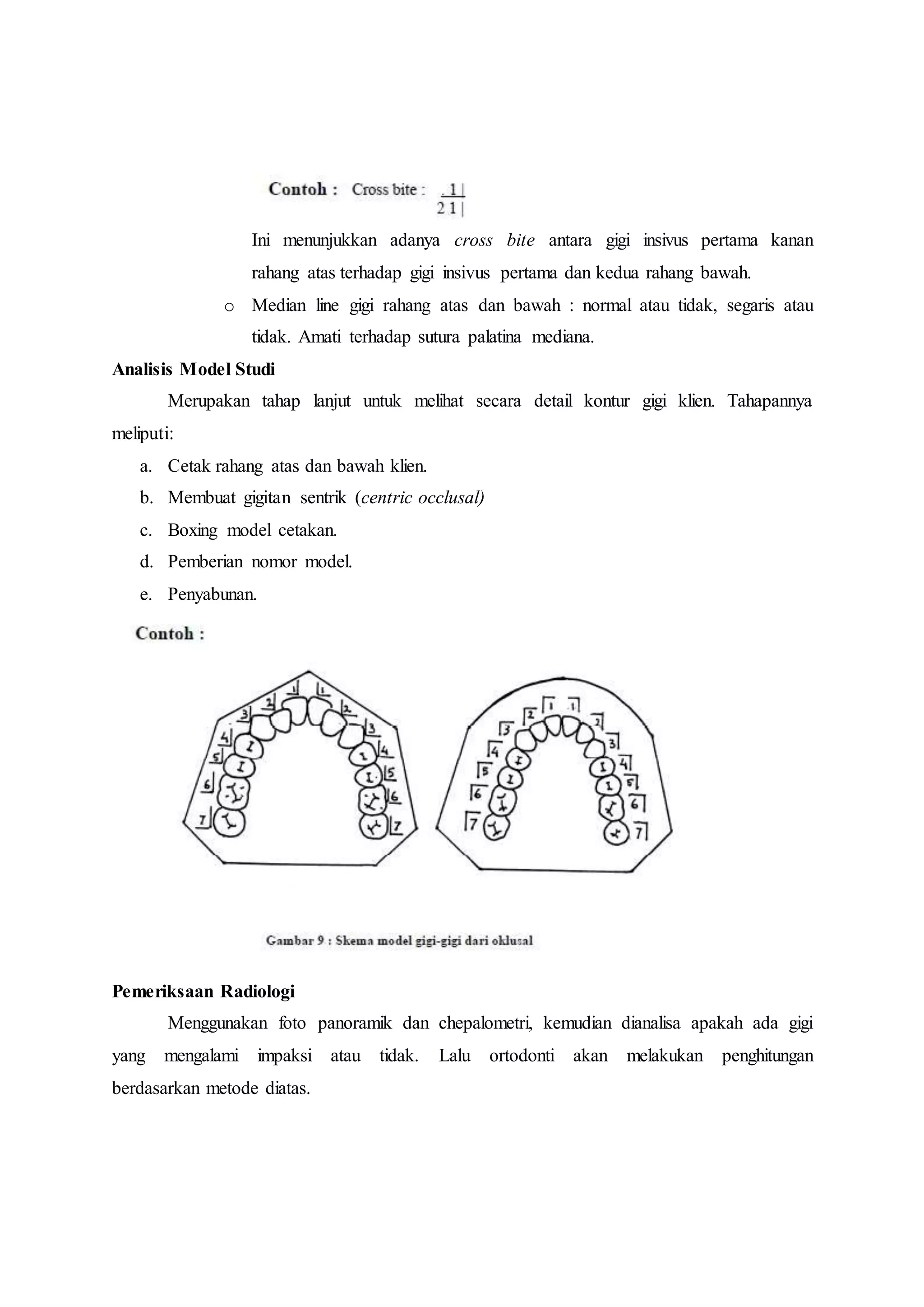 Asuhan keperawatan maloklusi - pemeriksaan dan penatalaksanaan | DOCX