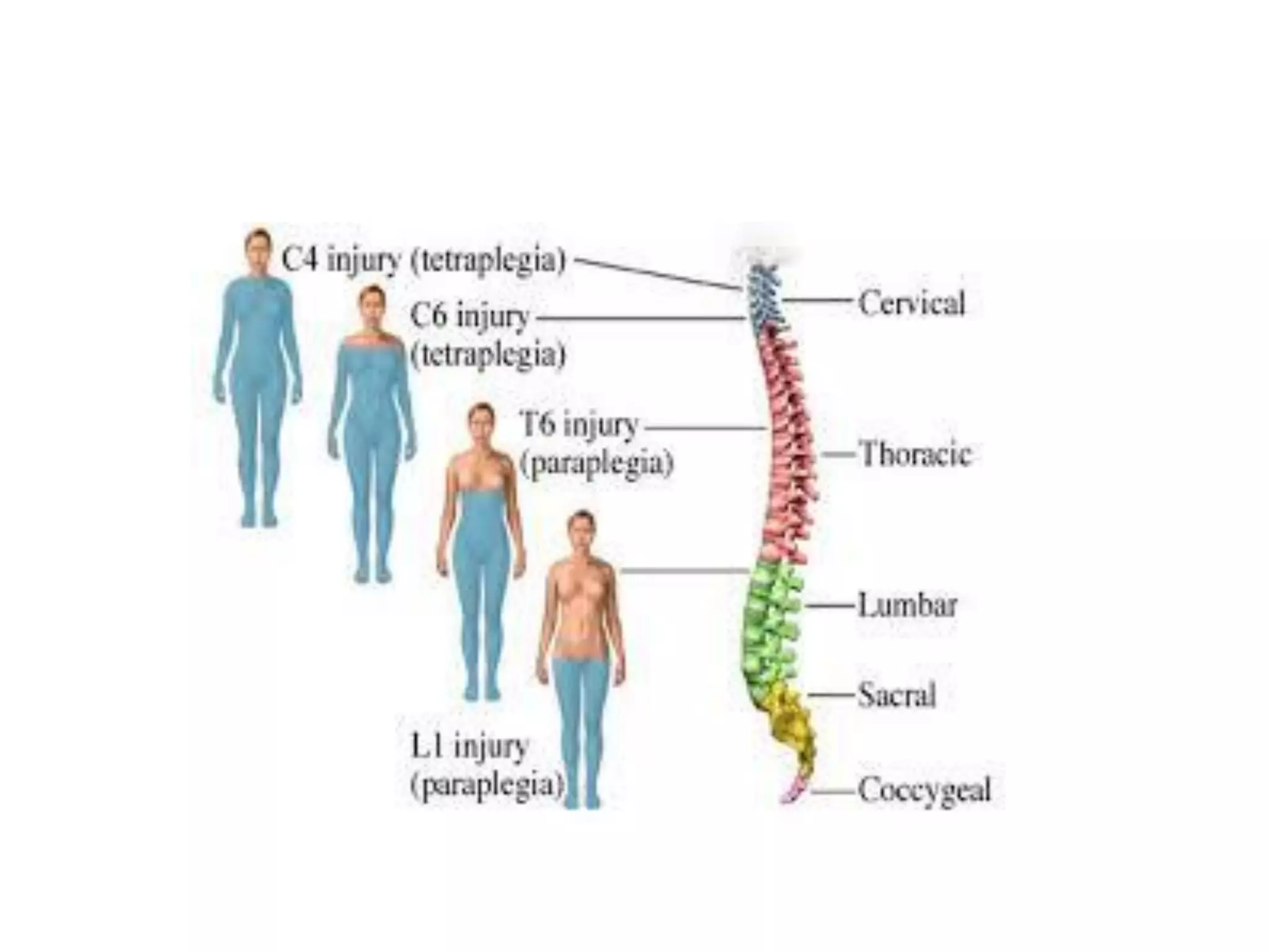 Asuhan keperawatan pada trauma medula spinalis | PDF
