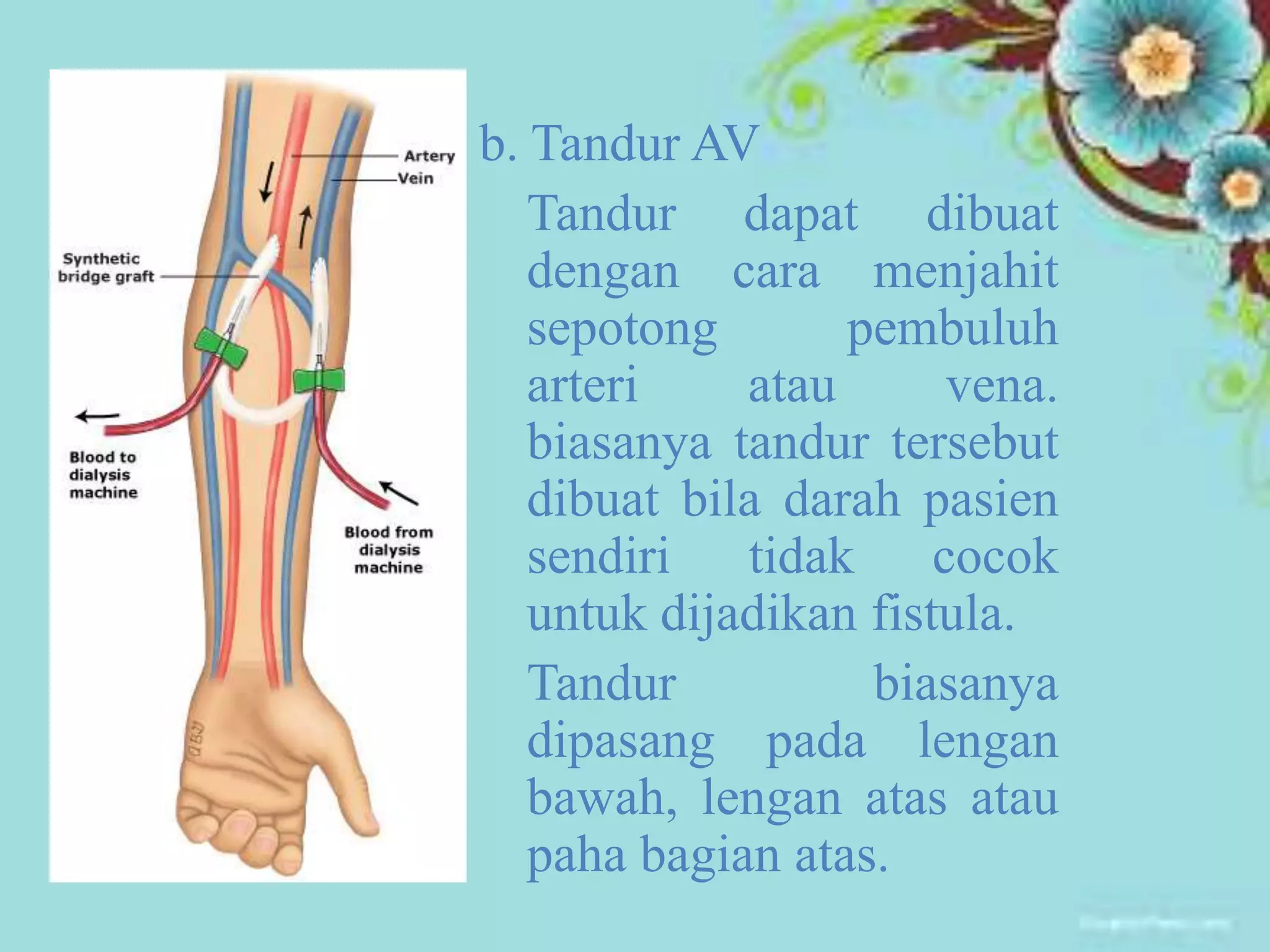 Asuhan keperawatan hemodialisa | PPTX