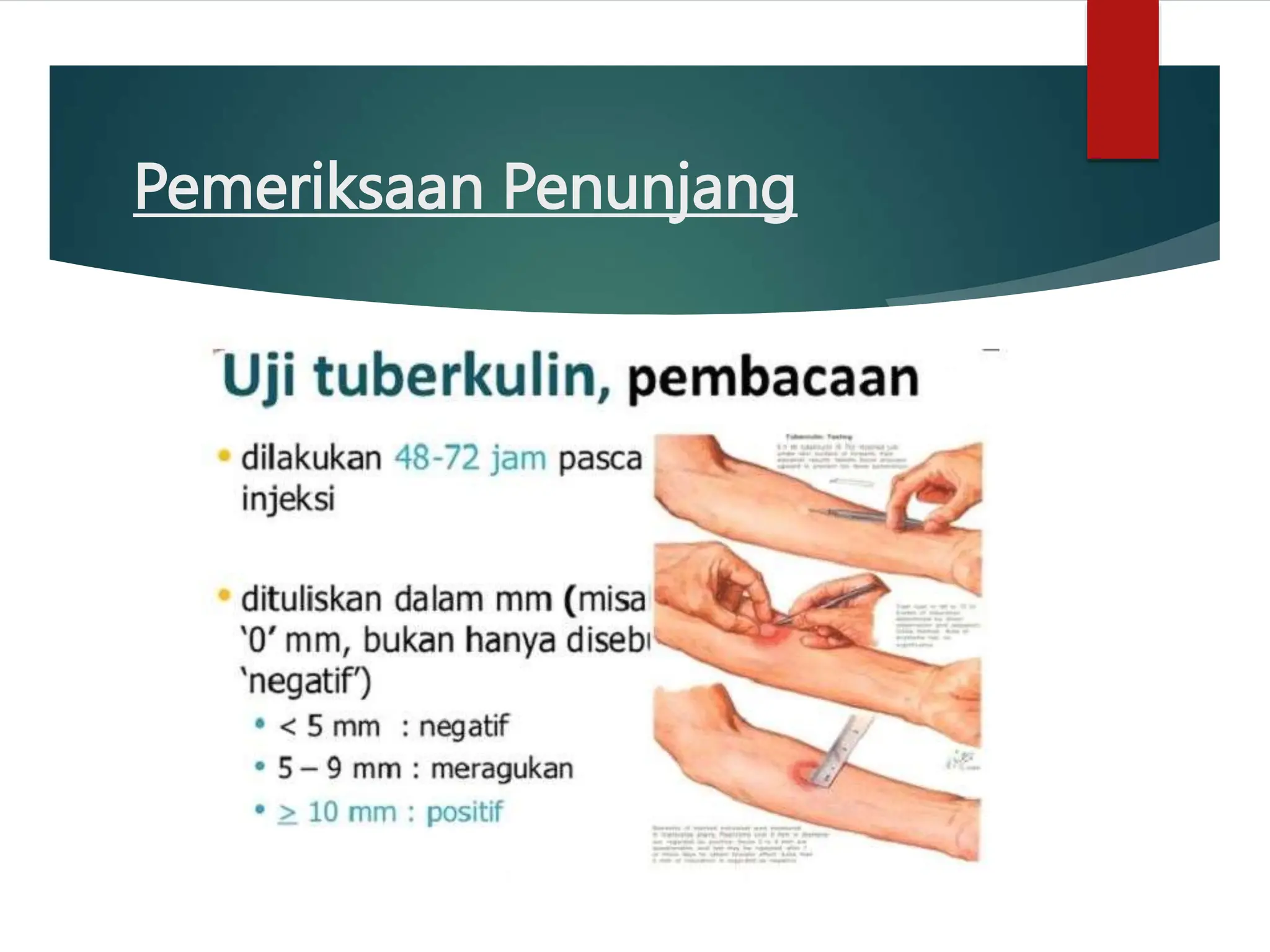 Asuhan_Keperawatan_Pada_Pasien_dengan_TB.pptx