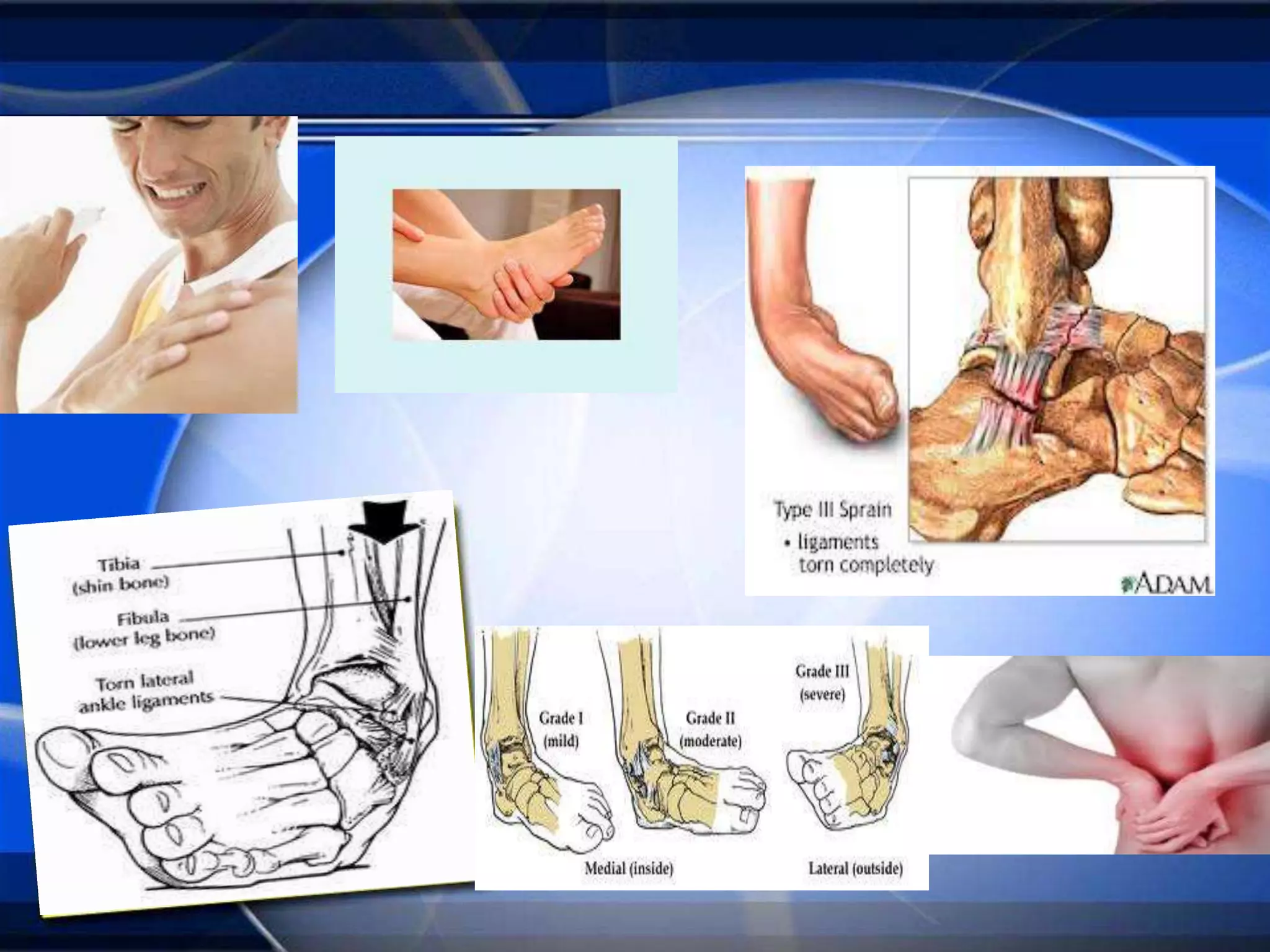 Asuhan keperawatan sprain | PPTX