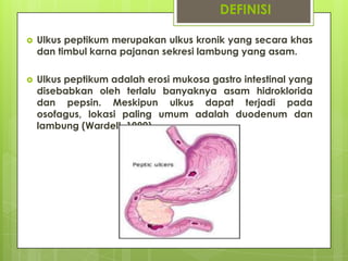 Asuhan keperawatan ulkus peptikum..... | PPT